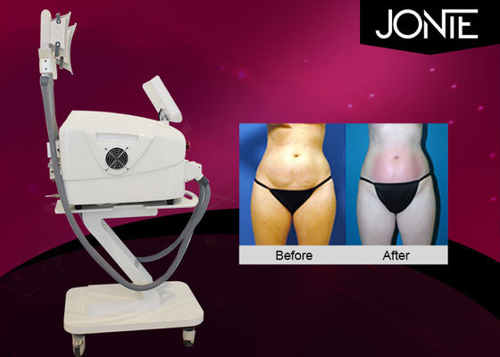 Two Handles Slimming Beauty Equipment for Fat Reduction Vacuum Cellulite Removal