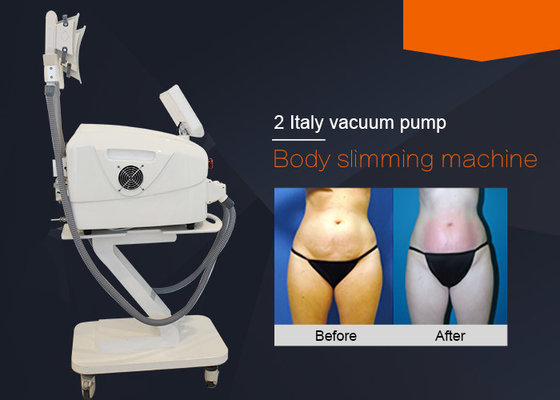 Professional Cryolipolysis Slimming Machine 60Hz Safety Cellulite Removal Device