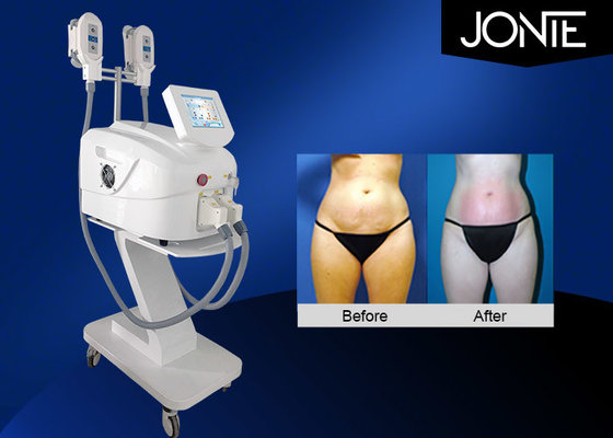 Anti - Puffiness Cryolipolysis Slimming Machine 2 Handles Cellulite Removal Machine