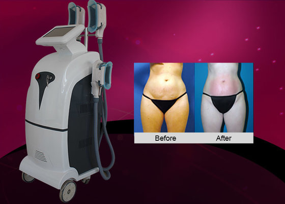 Easy to use 10 Inch Screen Cryolipolysis Body Slimming Machine with teaching video