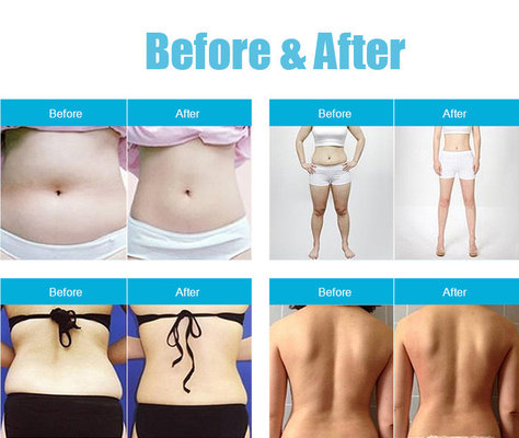Low price amazing effect distributors wanted slimming machine cryolipolysi fat freezing machine