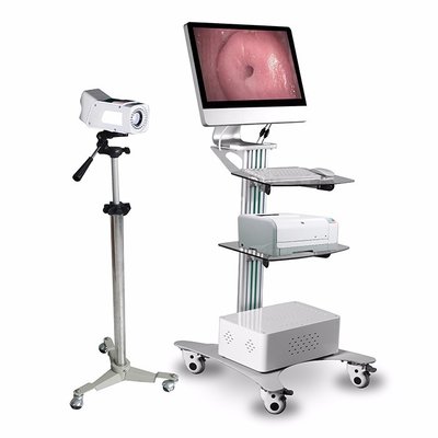 Specialized Digital Electronic Colposcope with 3.5 inch Double monitor supplier