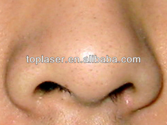 Female Face Lifting Skin Rejuvenation Equipment PDT With Touch Screen