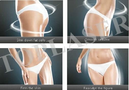Female Cryolipolysis Slimming Machine Multifunctional Home Beauty Device