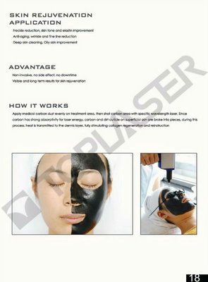 High Power 200 mj/ Single Pulse Q-switch Nd Yag Laser , Nd Yag Laser For Tattoo Removal