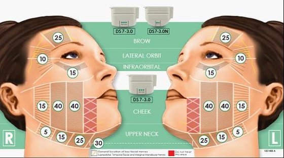 Toplaser Beauty Shaping Hifu Machine 10" Color Touch Display Screen