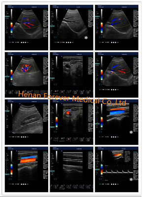 3D/4D Cw Function Color Doppler