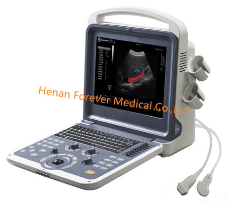 Medical Diagnosis Equipment 3D/4D Color Doppler Ultrasound