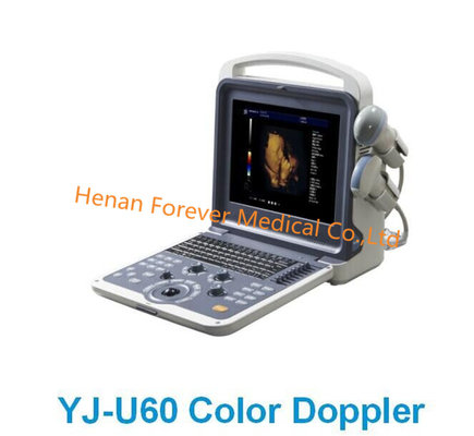 Medical Diagnosis Equipment 3D/4D Color Doppler Ultrasound