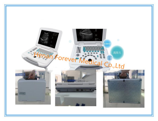 China Factory Price Medical Full-Digital Laptop Ultrasound Scanner