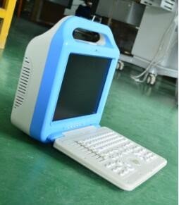 Gynaecology Full Digital B Model Portable Gynecology Ultrasound