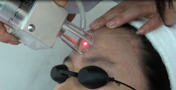 RF Tube Co2 Skin Rejuvenation Laser Machine , Laser Skin Care Machine