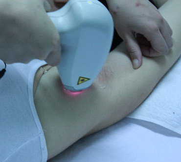Professional 808nm Hair Epilation Machine , Diode Laser Machine For Bikini Area