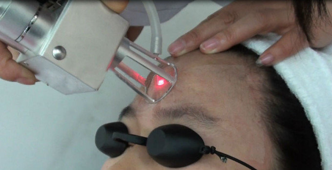 RF Tube Co2 Skin Rejuvenation Laser Machine , Laser Skin Care Machine